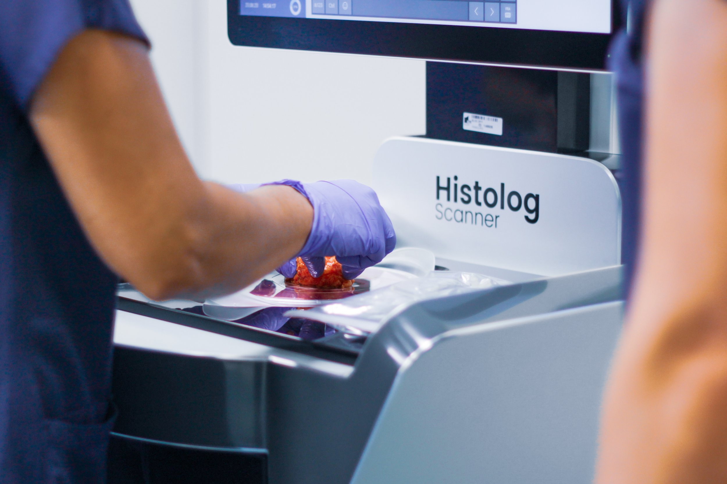 Mutuelles Impact soutient SamanTree Medical dans le cadre de sa série B ...